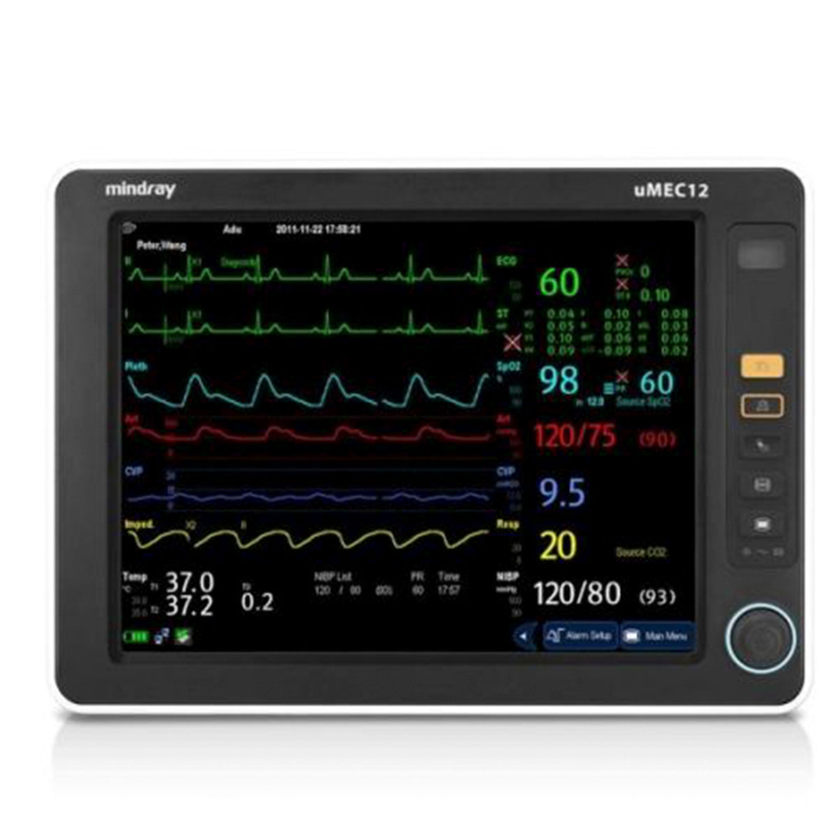 Mindray uMEC12 Patient Monitor ECG | Mindray Accessories Australia– LSR ...