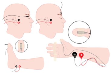 Nerve Stimulator and Twitch Monitor - TOF3D– LSR Healthcare