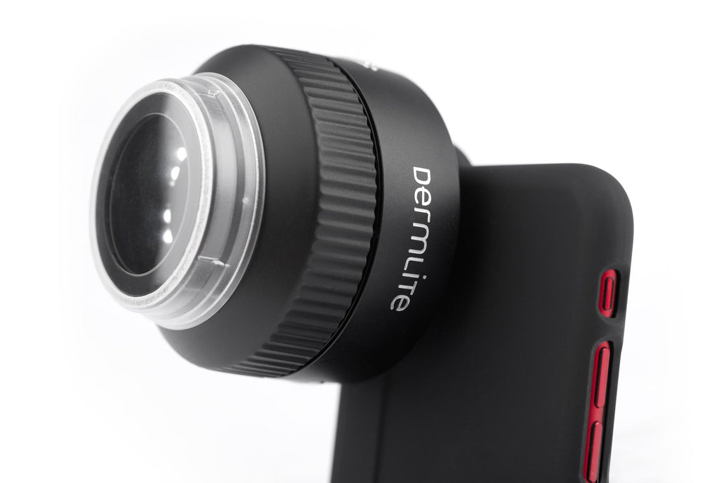 DermLite Foto X Universal Dermatoscopic Lens | LSR Healthcare